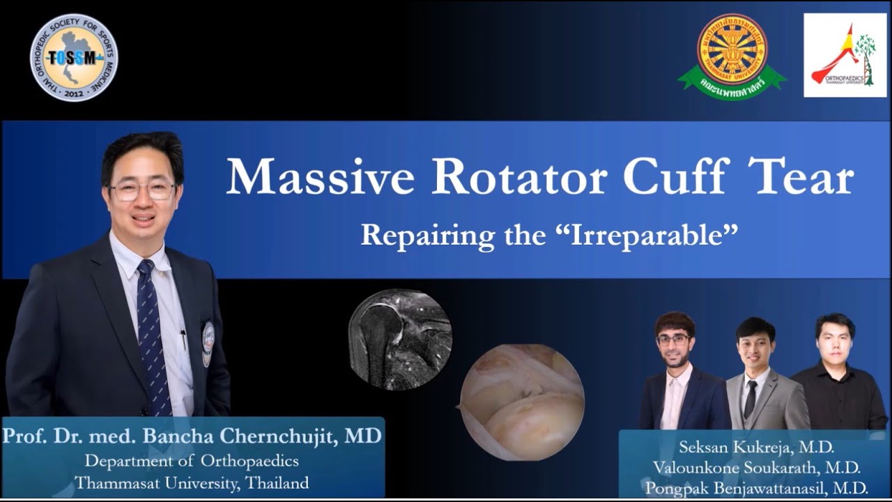 Massive cuff tear: How to Repair the Irreparable Rotator Cuff Dr ...