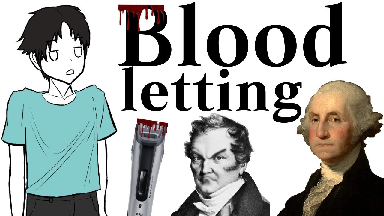 History of Bloodletting: bleeding a day keeps the doctors away - YouTube