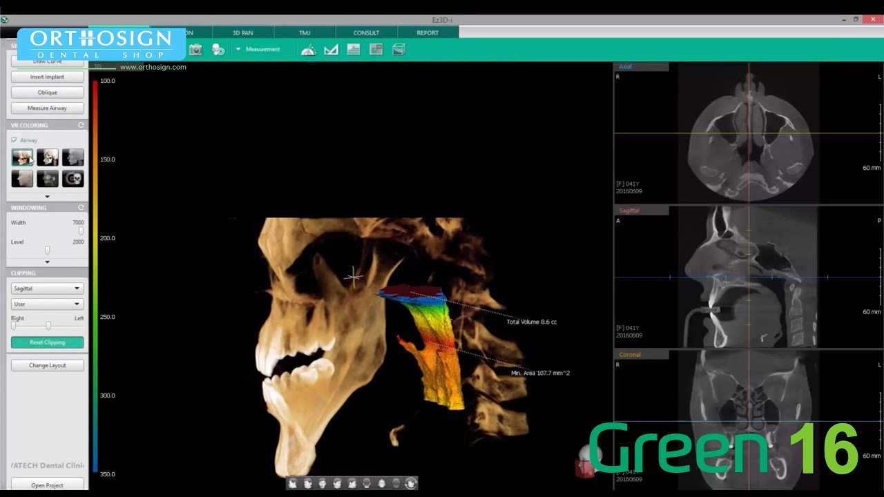 Tomografía Dental FOV 16x9 Vatech Green 16 3D Cone Beam + Pano + Ceph ...