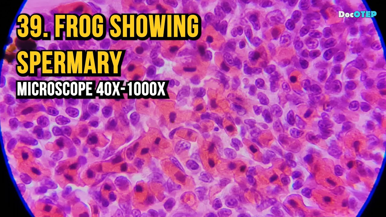 39. Frog Showing Spermary (Microscope 40x-1000x) - YouTube