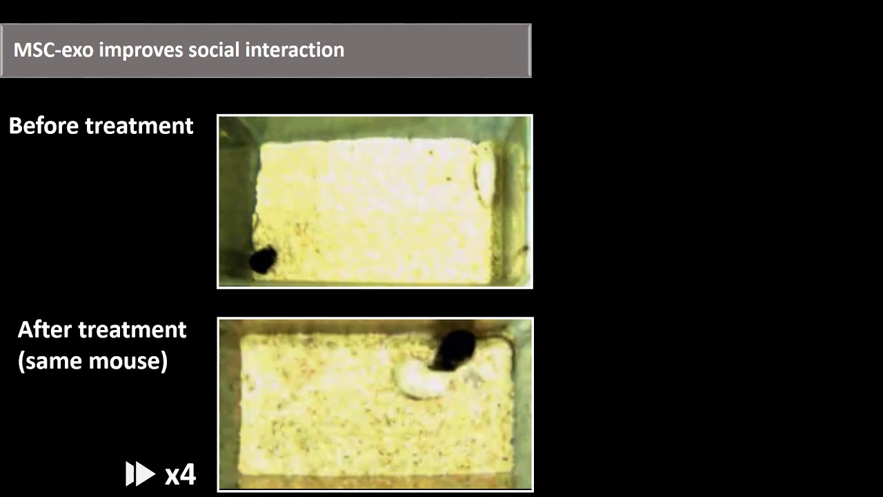 Social interaction before and after treatment - YouTube