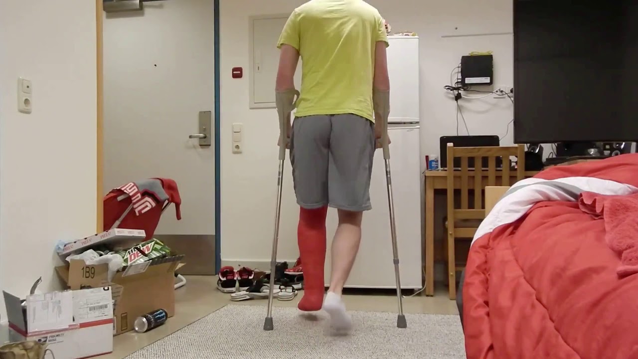 Red Long Leg Cast - YouTube