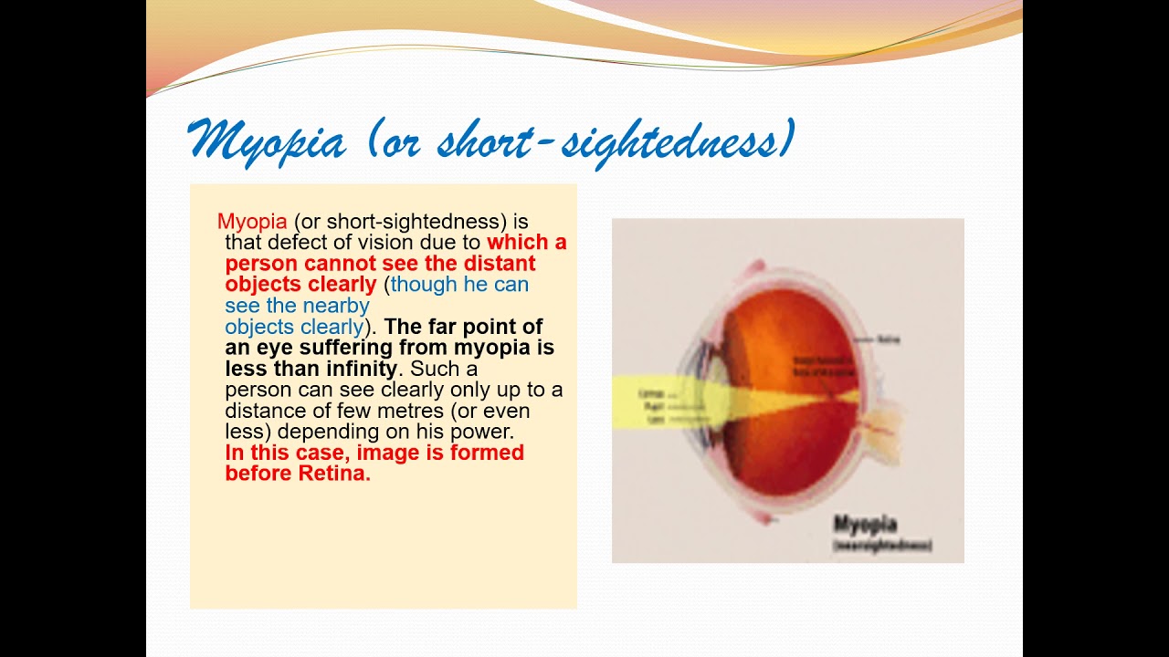 Common Human Eye Defects - YouTube