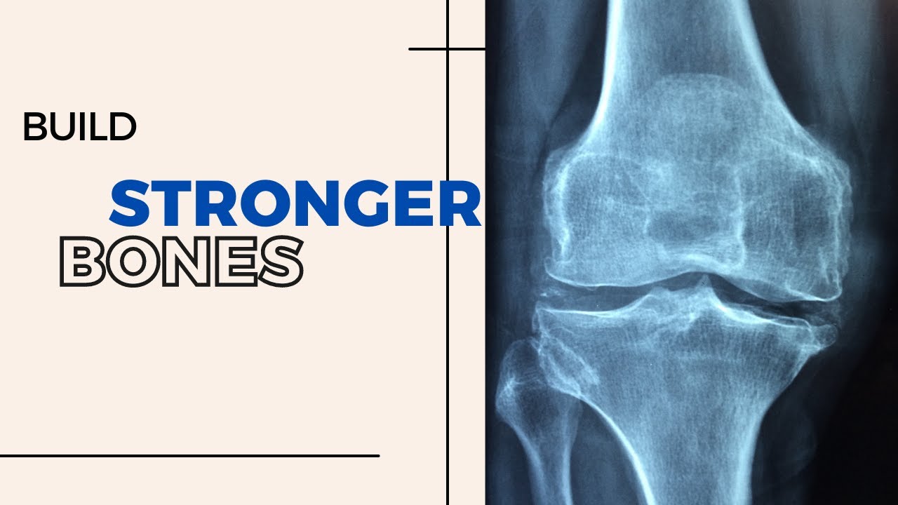 How To Treat Osteoporosis: 11 Ways to Build Stronger Bones - YouTube