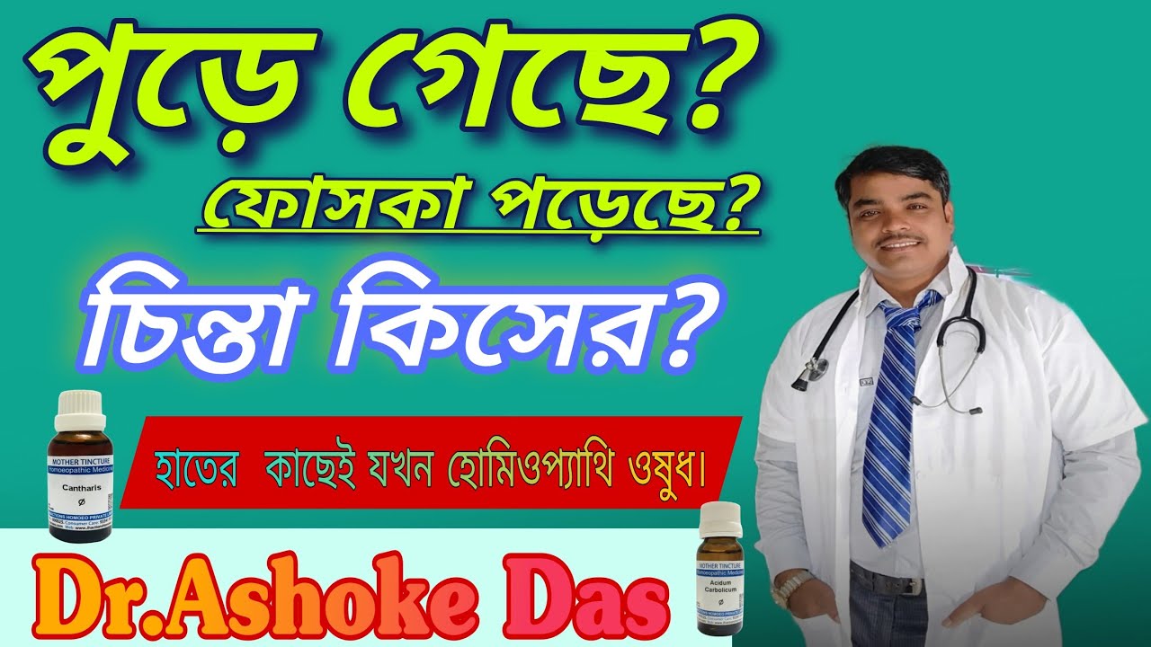 পুড়ে ফোসকা পড়ে গেছে//হোমিওপ্যাথিক সেরা মেডিসিন Dr.Ashoke Das ...