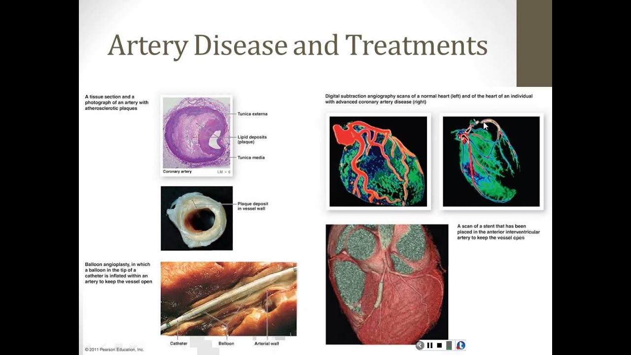 Heart and Cardiovascular System - Part 2 - YouTube