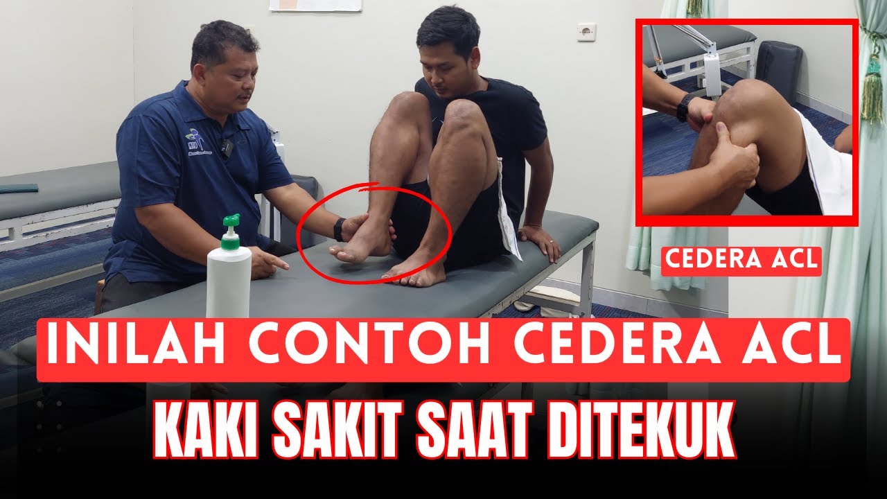 MCO ARIF - INILAH CONTOH CEDERA ACL, KAKI SAKIT SAAT DITEKUK - YouTube