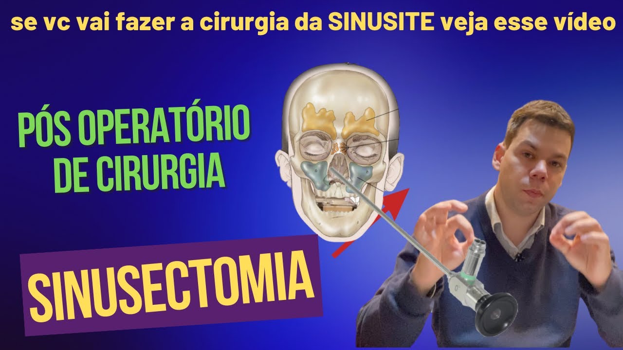 PÓS OPERATÓRIO DA CIRURGIA DE SINUSITE (SINUSECTOMIA) - YouTube