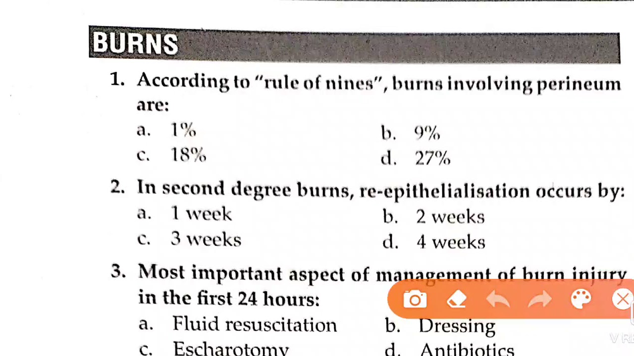 Burn mcq for fmge - YouTube
