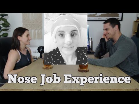 Nose Job Experience