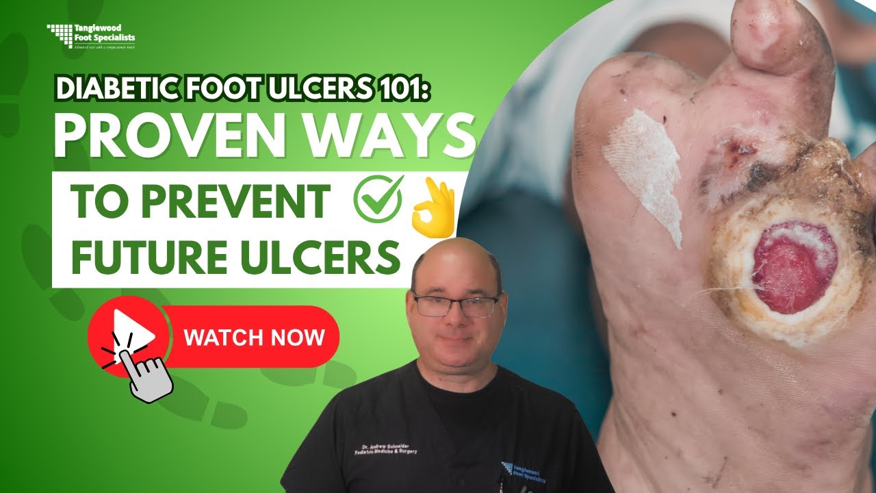 Diabetic Foot Ulcers 101: How to Prevent Ulcers from Coming Back - YouTube