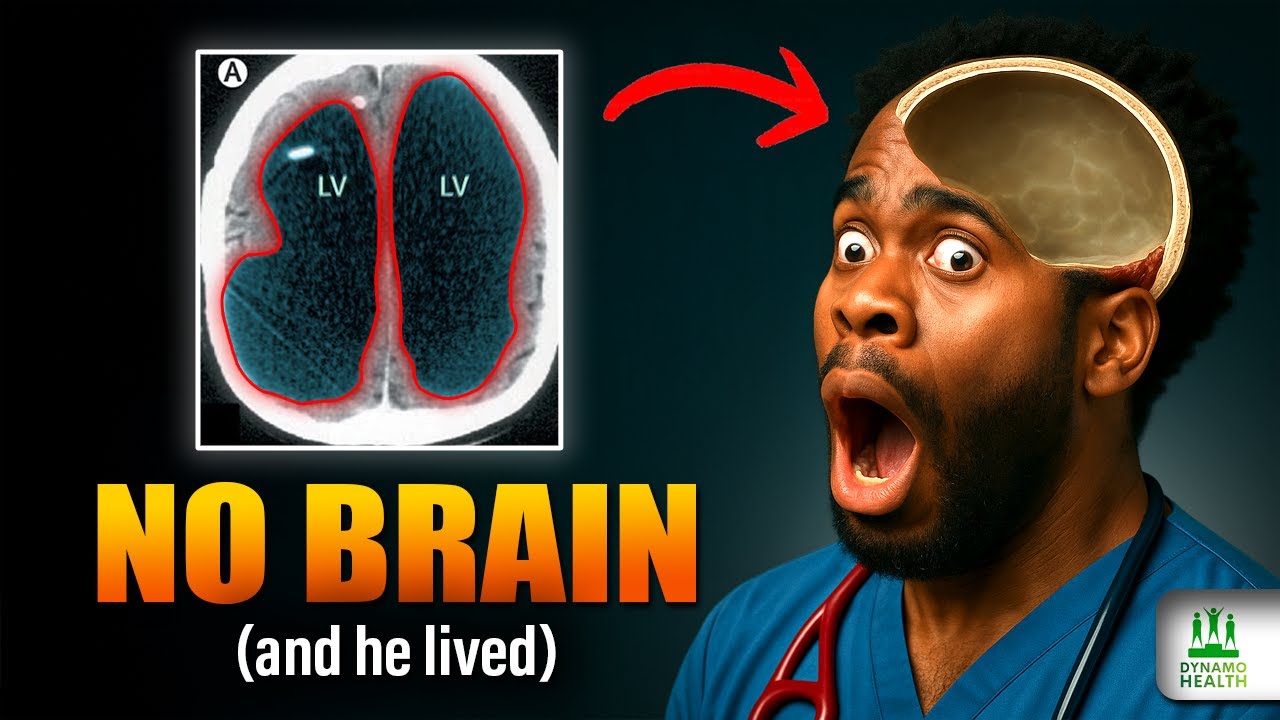 Doctor Explains the Man With Almost No Brain | Critical Encounters ...