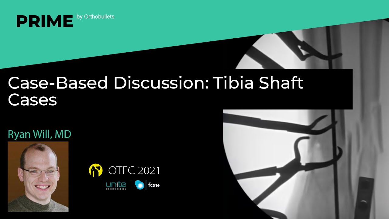 Case-Based Discussion: Tibia Shaft Cases - Ryan Will, MD - YouTube
