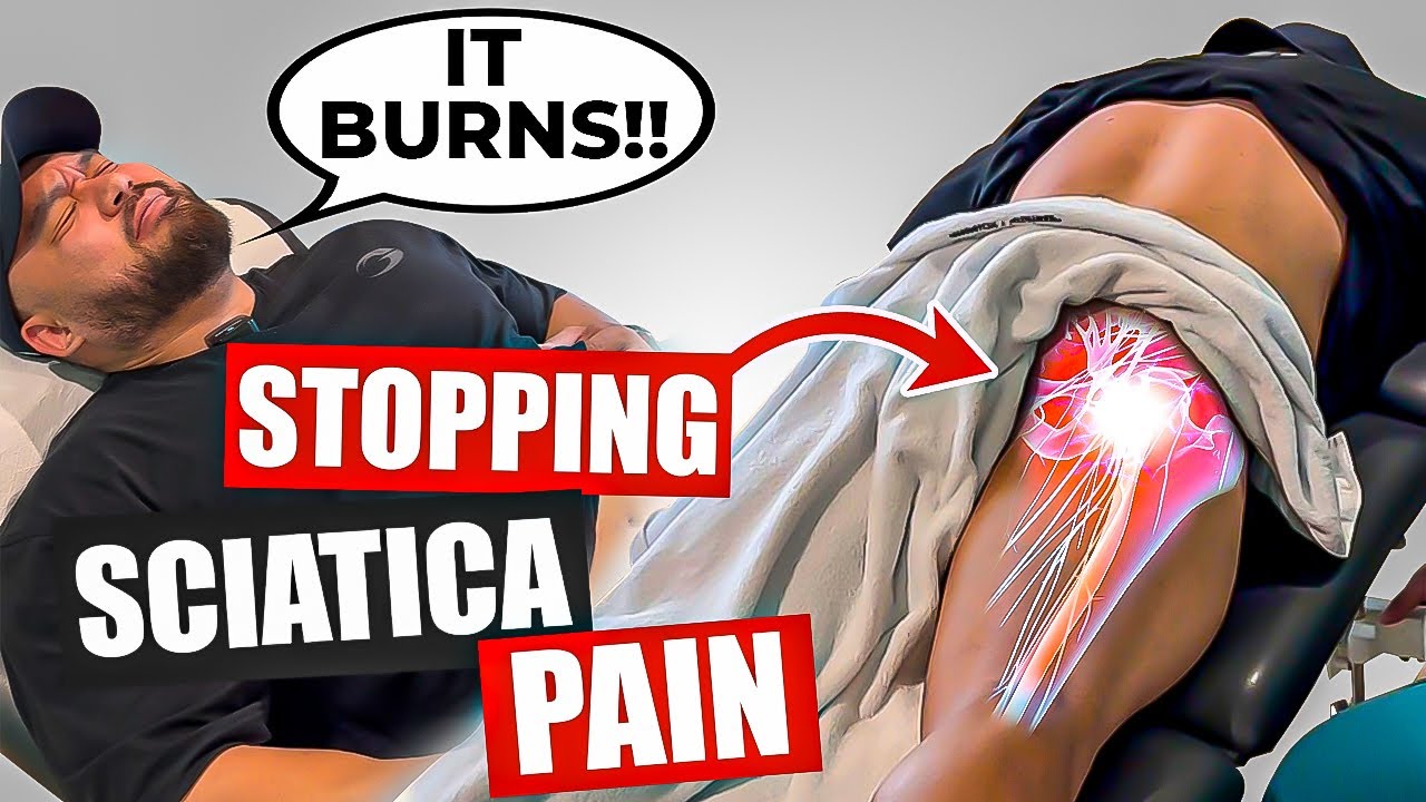 GAME-CHANGING Sciatica Treatment for INSTANT Sciatica Pain Relief - Dr ...