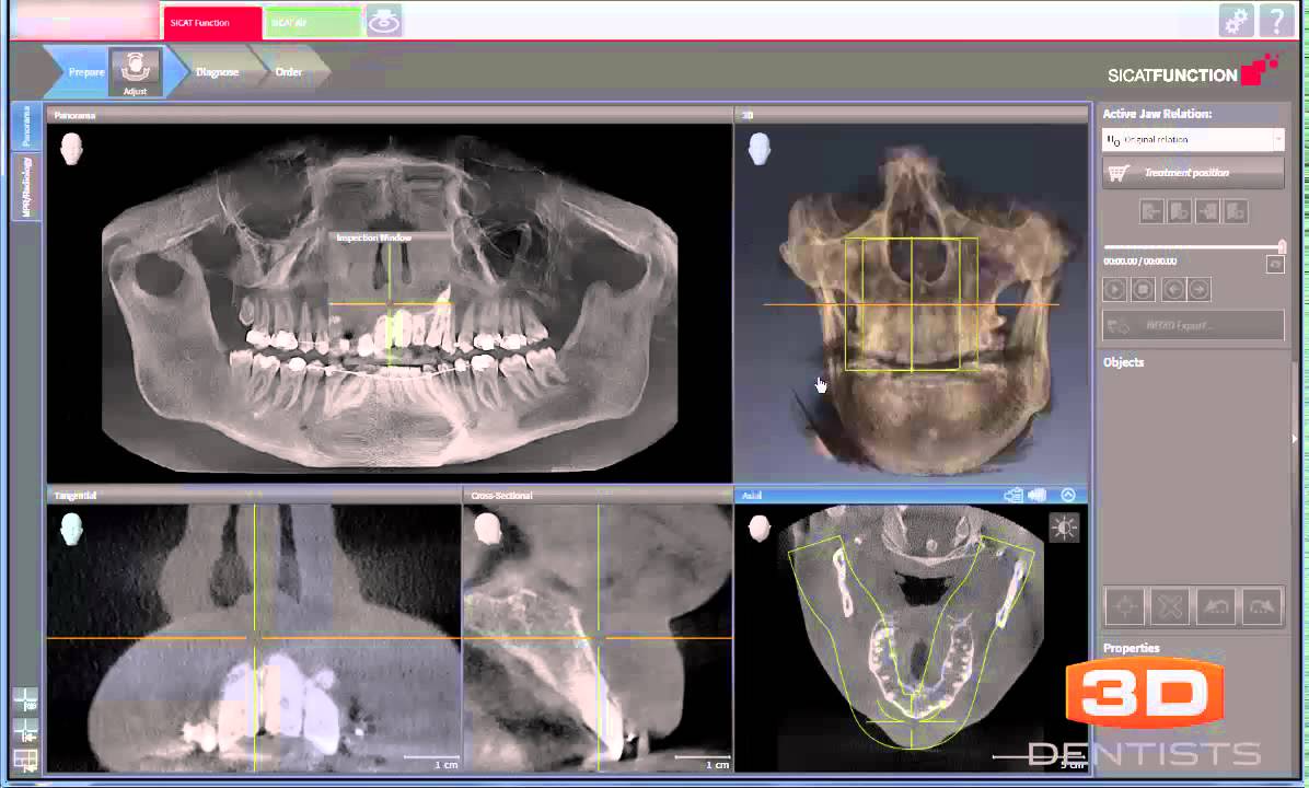 SiCAT Air Introduction by 3D Dentists - YouTube
