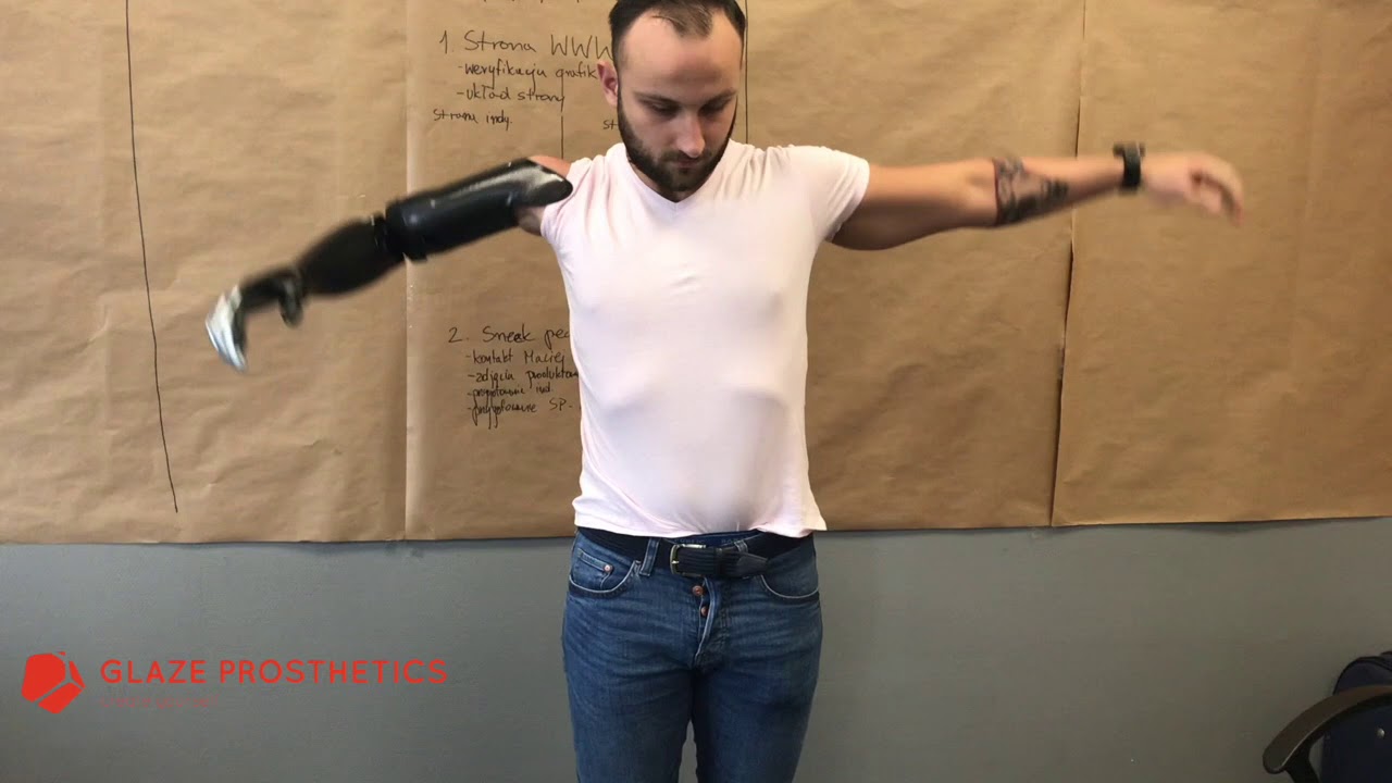 Four arm prosthetics - one socket - YouTube