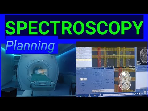 MR SPECTROSCOPY Planning step by step #MRS planning #Mri Brain +MRS ...