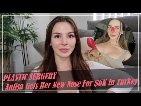 PLASTIC SURGERY '90 Day Fiance' Anfisa Arkhipchenko Gets Her New Nose For $6K In Turkey