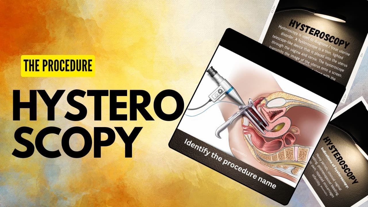 Hysteroscopy diagnostic & therapeutic procedure, Hysteroscope ...