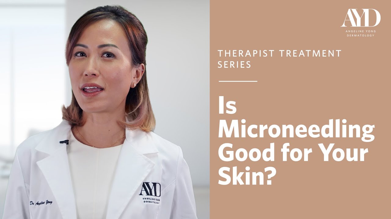 Is Microneedling Good For Your Skin? | Angeline Yong Dermatology - YouTube