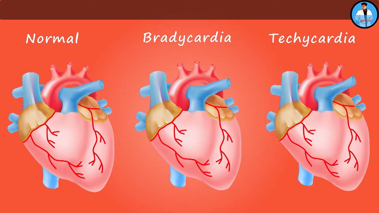 Bradycardia | Trachycardia | Anatomy of heart | Medicure | - YouTube