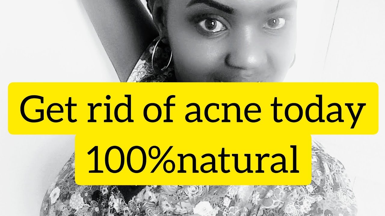 ACNE KENYA|ACNE REMOVAL TREATMENT #acnetreatment #darkcircles#pimples# ...