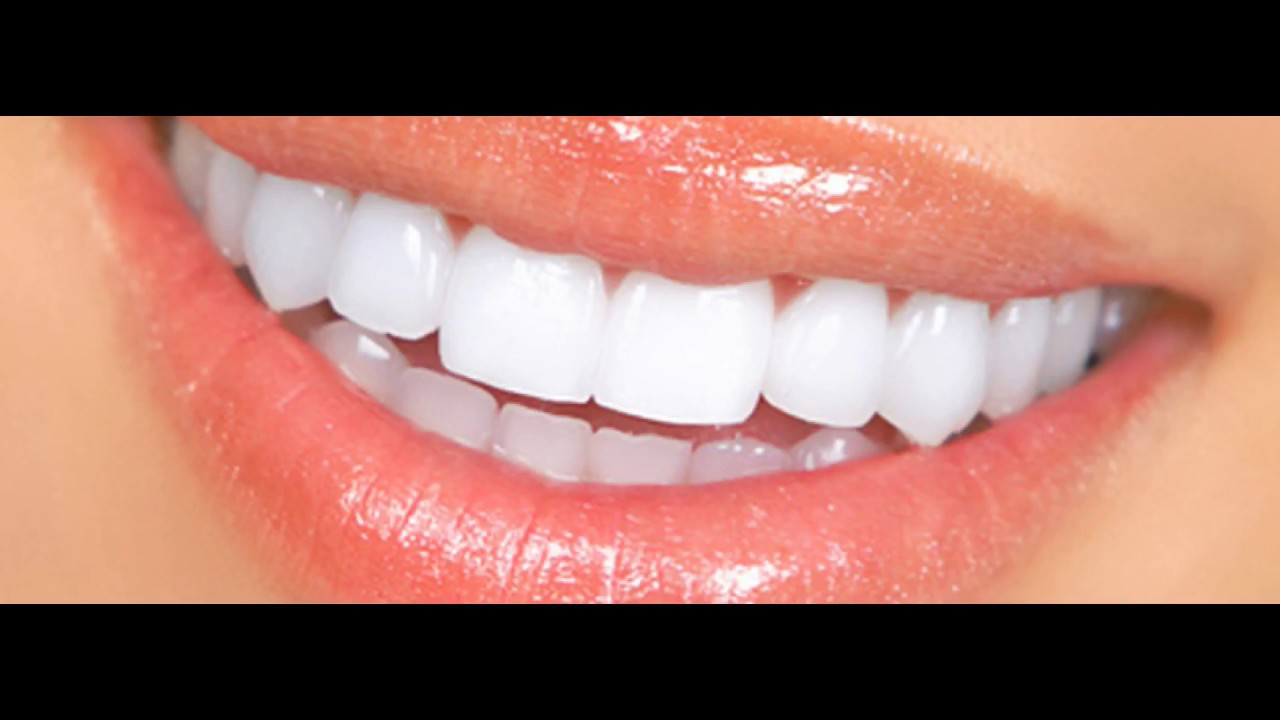 Perfect White Teeth