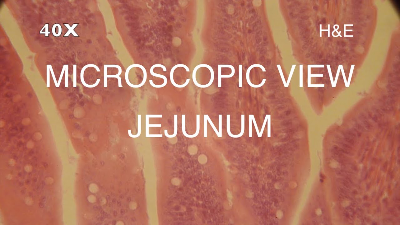 MICROSCOPIC VIEW - JEJUNUM - YouTube