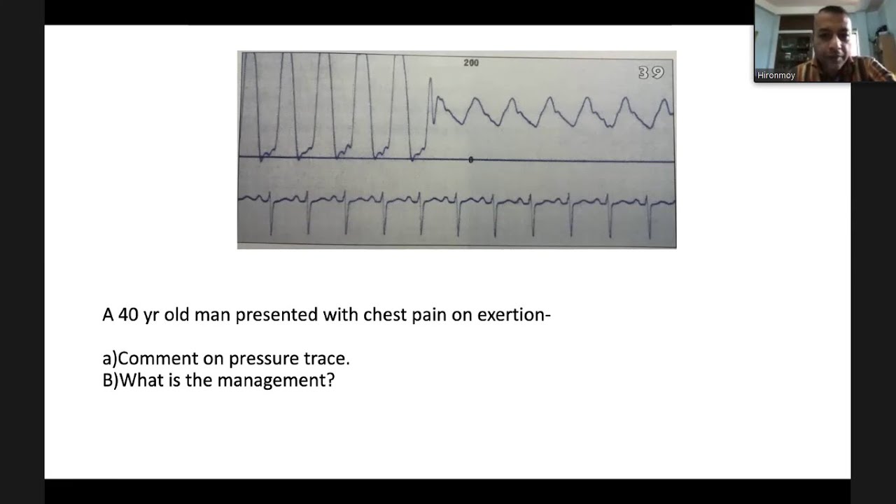 Cardiac Catheterization Data Interpretation by Dr. Hiranmoy Das sir ...