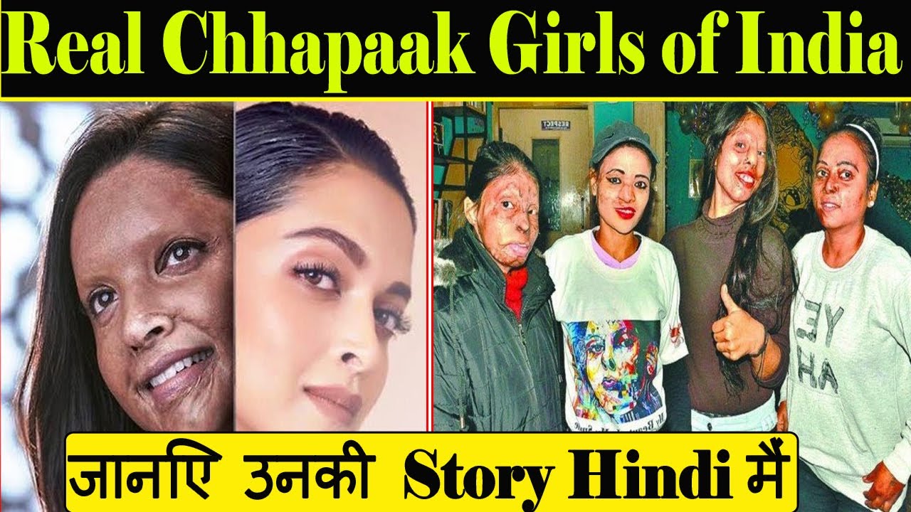 Real chhapaak girls of india | Real acid victims ledkio ki kahani ...
