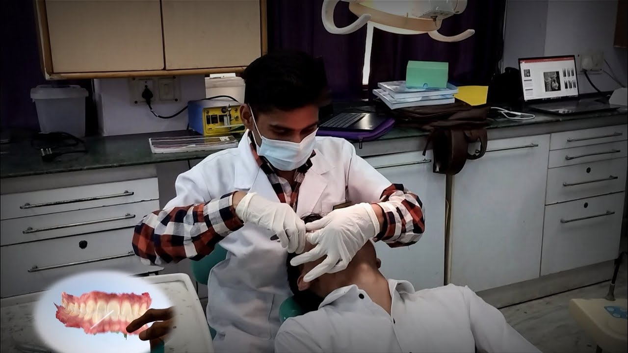 Debonding After complete Orthodontic treatment | Internship | #idst ...