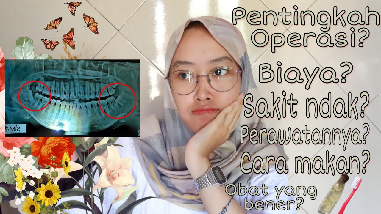 Pengalaman Operasi Gigi Bungsu - YouTube