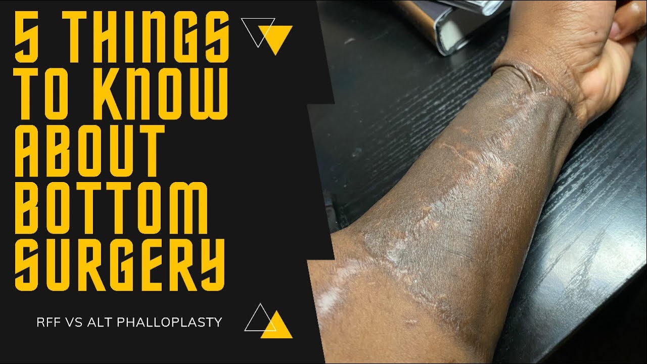 Black Trans Man: 5 Things to Know About Bottom Surgery | Kay Deshawn ...