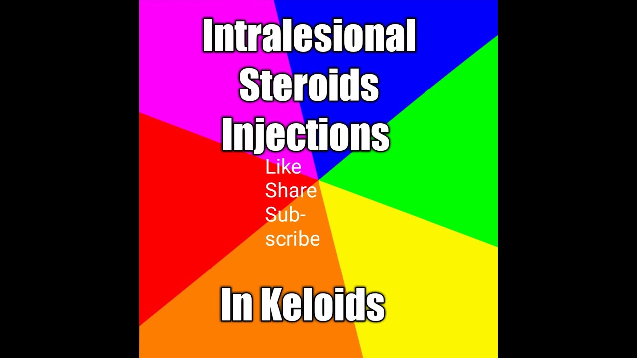 Intralesional Steroids Injections in keloid - YouTube