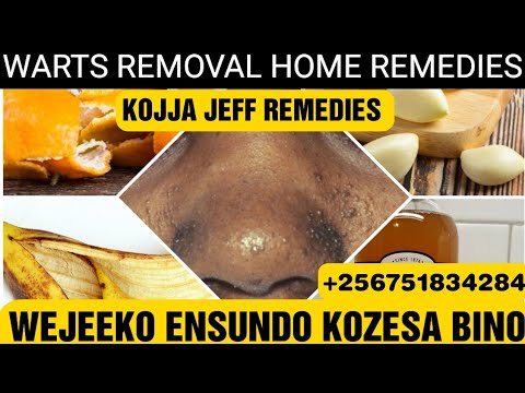 Alina Ensundo Ku Skin Kozesa Bino Eveeko - Kojja Jeff Remedies - YouTube