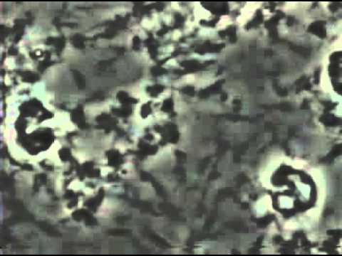 Spirochetes under phase contrast microscope - YouTube