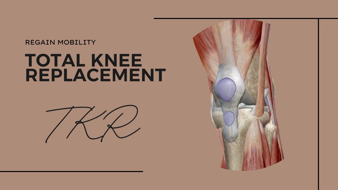 Regain mobility: Total Knee Replacement - YouTube