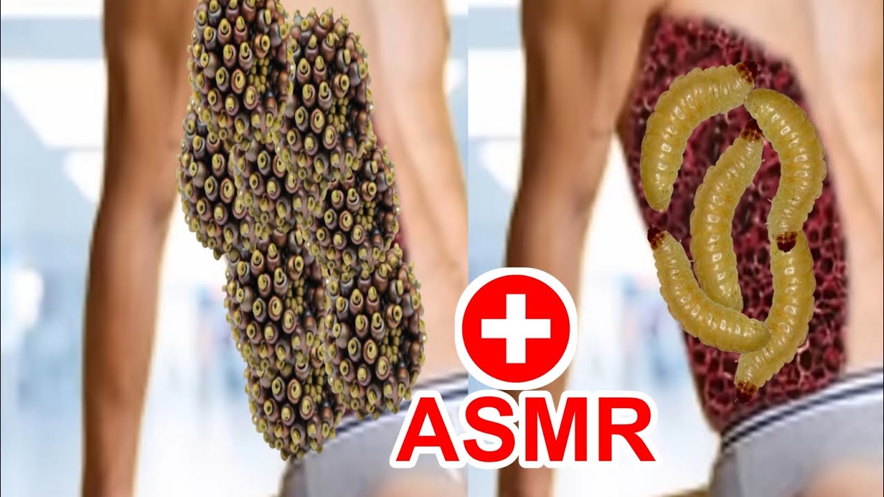 ASMR Animation treatment | Removal maggots infested dog ticks 😱 ...