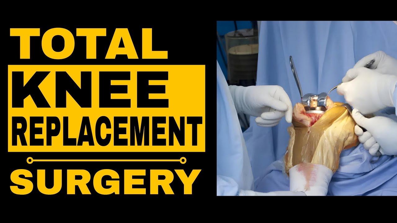 Step-by-Step Total Knee Replacement Procedure | Educational Video ...