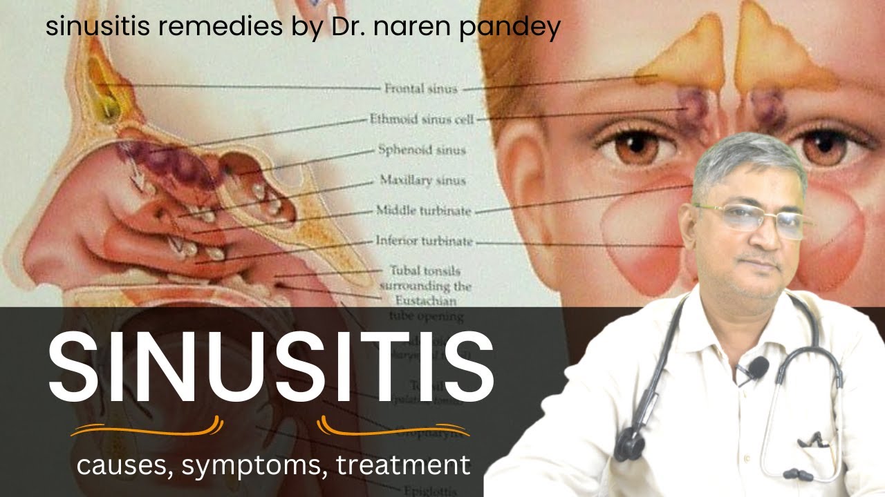 Sinusitis: The Ultimate Problem | Solutions to the Sinusitis Diagnosis ...