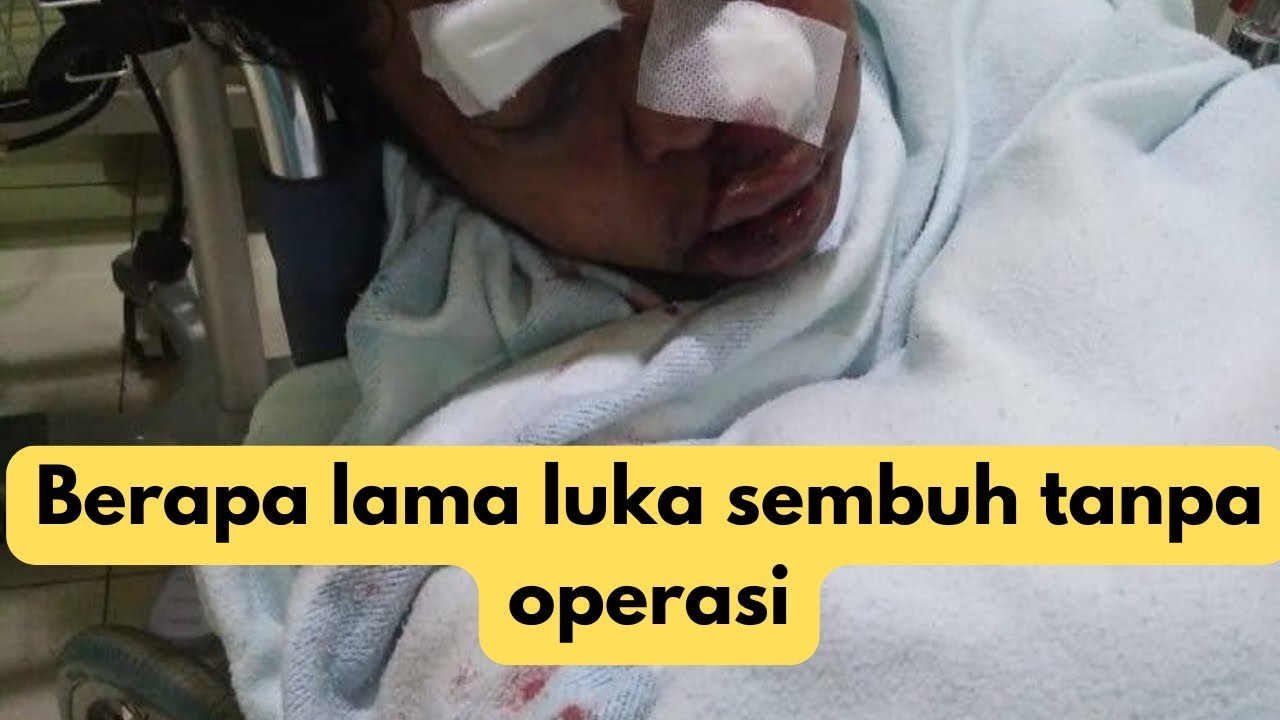 BERAPA LAMA LUKA YANG PARAH BISA SEMBUH - YouTube