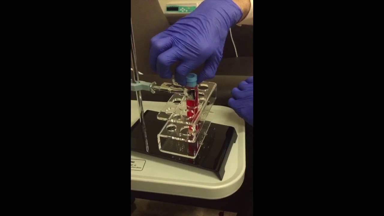 Preparing a PRP Injection Final Edit - YouTube