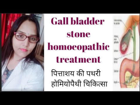Gall bladder stone ke liye homoeopathic treatment/पित्ताशय की पथरी के ...