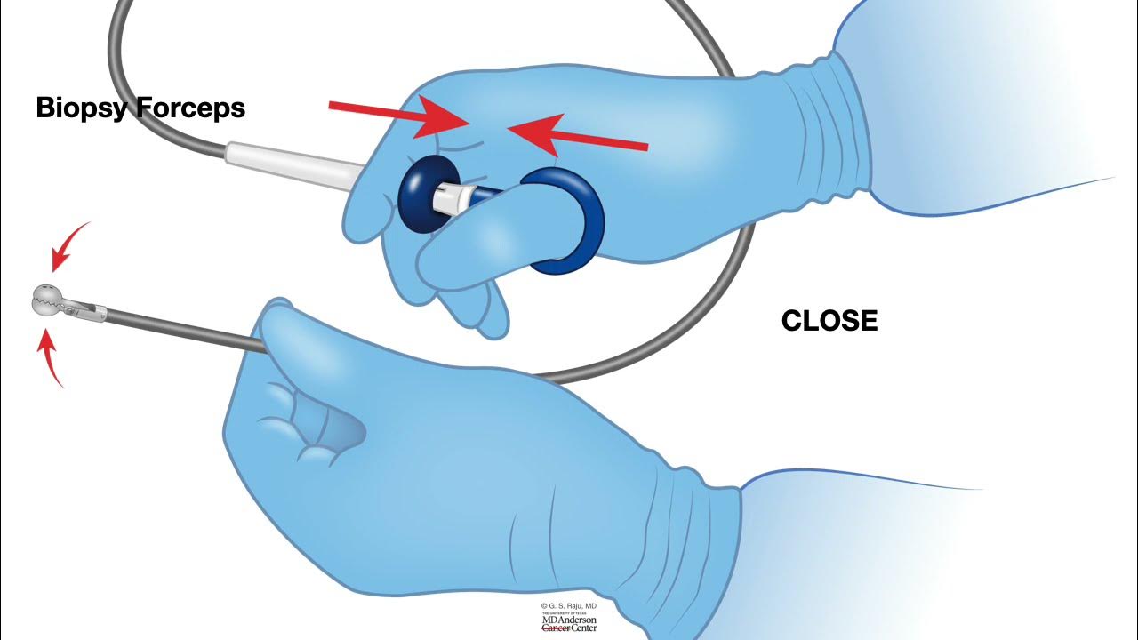 HCC 1472-Lesson 9a Tissue biopsy and handling - YouTube