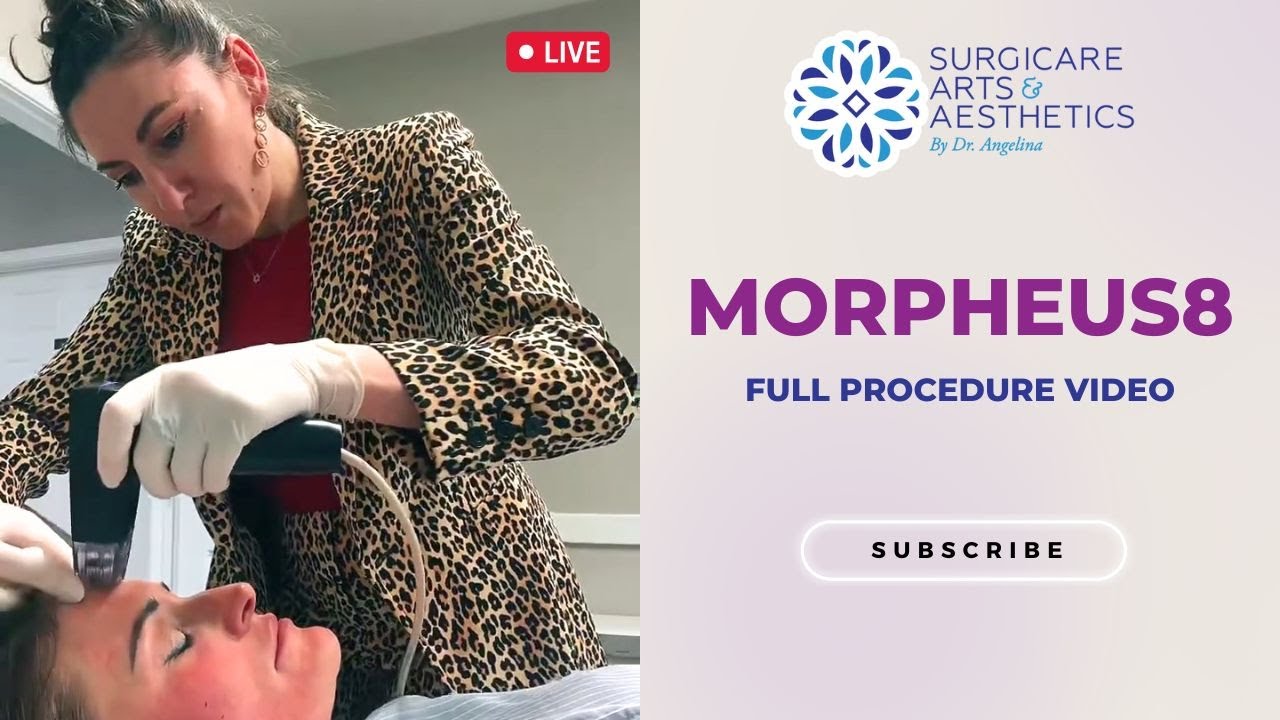 Morpheus8 - Full Procedure Video - Dr. Angelina Postoev - YouTube