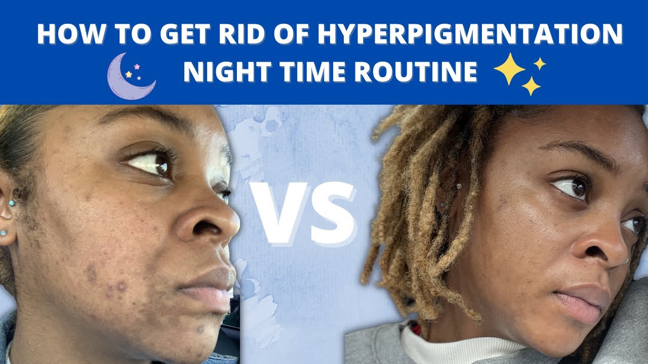 PM/NIGHT TIME SKIN CARE ROUTINE TO REMOVE DARK SPOTS AND ...