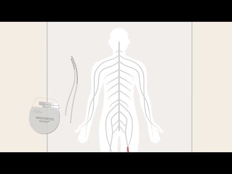 How To Tell When Boston Scientific Icd Checkup Is Completed