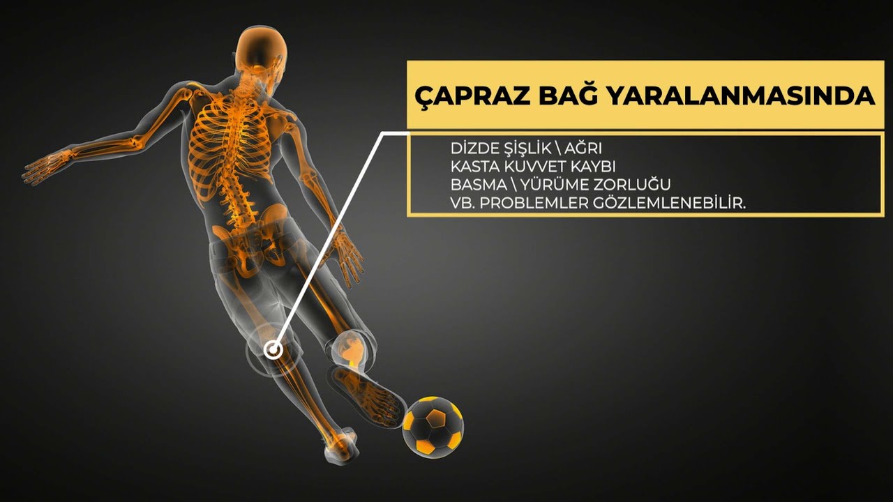 Çapraz Bağ Yaralanmaları - YouTube
