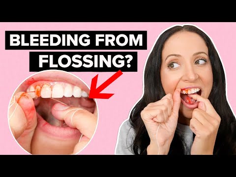Why Do Gums Bleed When Cleaning Teeth