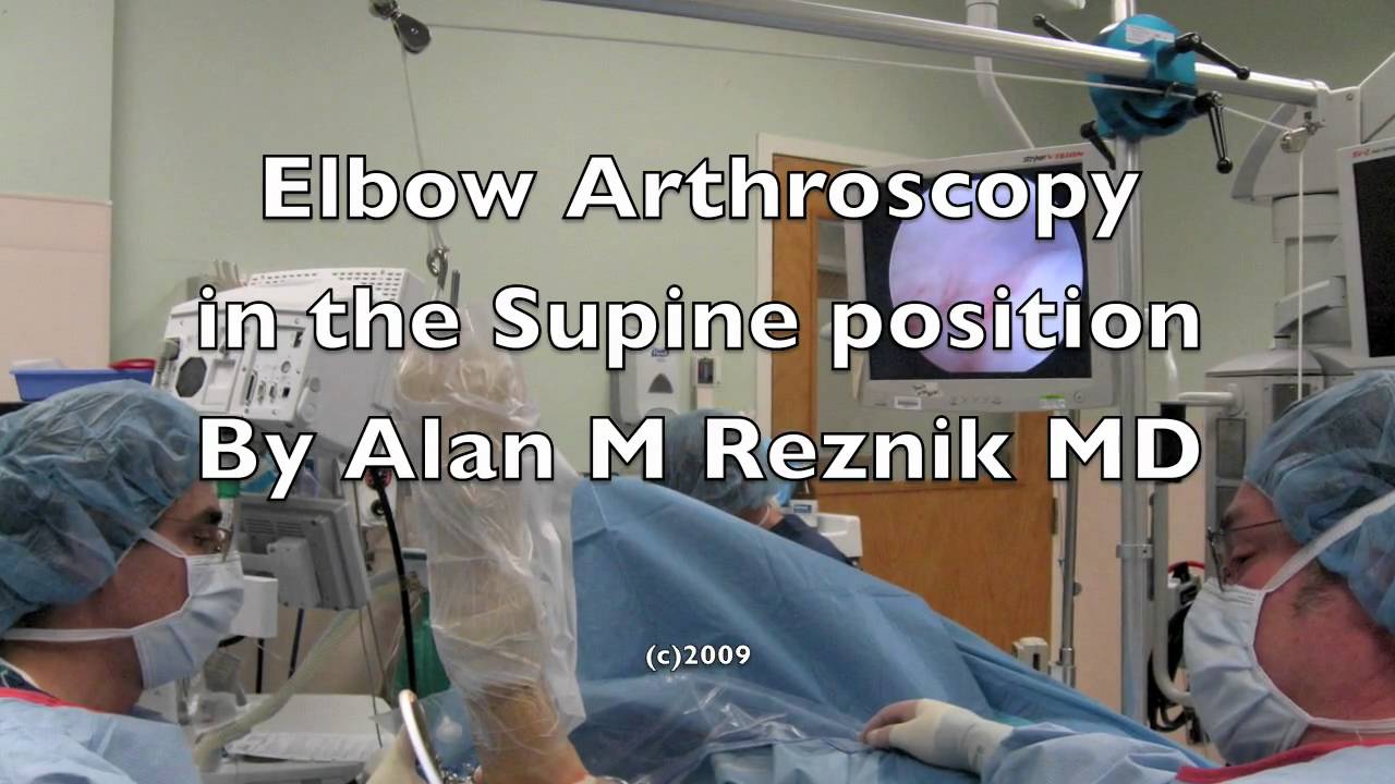 Locking Elbow Arthroscopy Dr Alan Reznik - YouTube